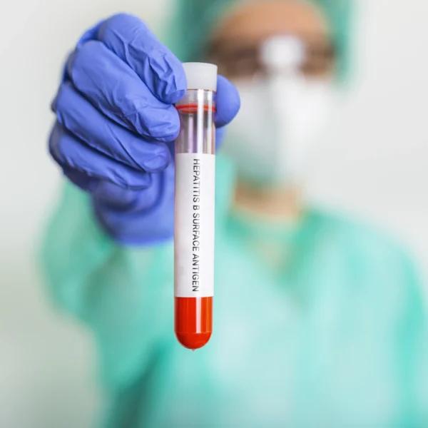 Hepatitis B Surface Antigen (HBsAg) Test - LifeBlood