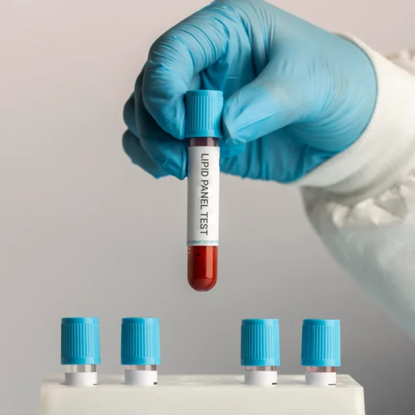 Lipid Panel Test - LifeBlood