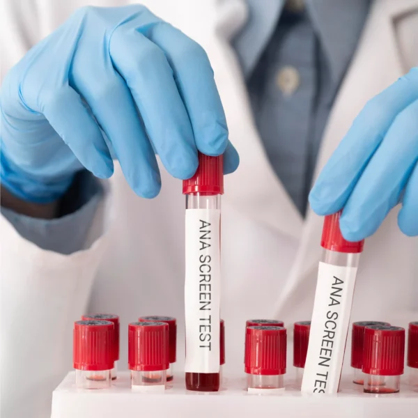 Antinuclear Antibody (ANA) Screen Test - LifeBlood